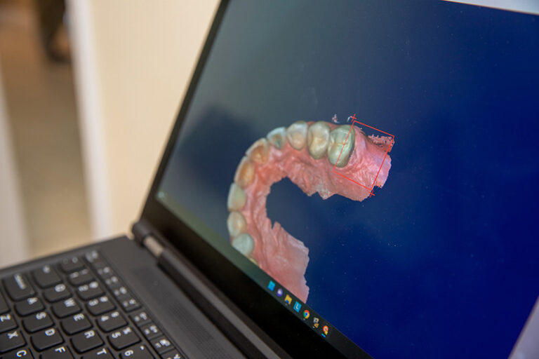 State-Of-The-Art Dental Lab | Ferber Dental | Greenacres, FL